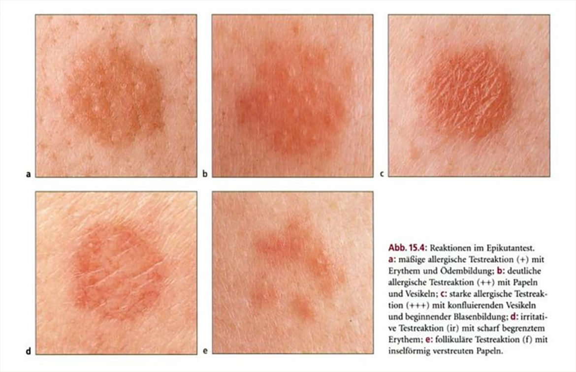Dermatologisch getestet - was bedeutet das eigentlich? - Incipedia